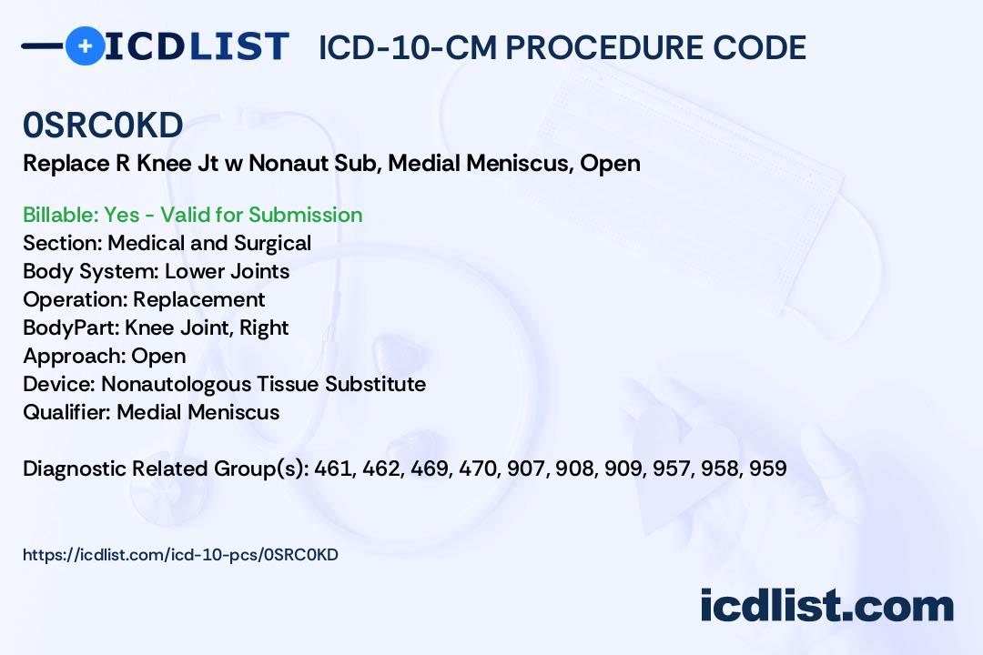 ICD-10-PCS Procedure Code 0SRC0KD - Replacement of Right Knee Joint ...