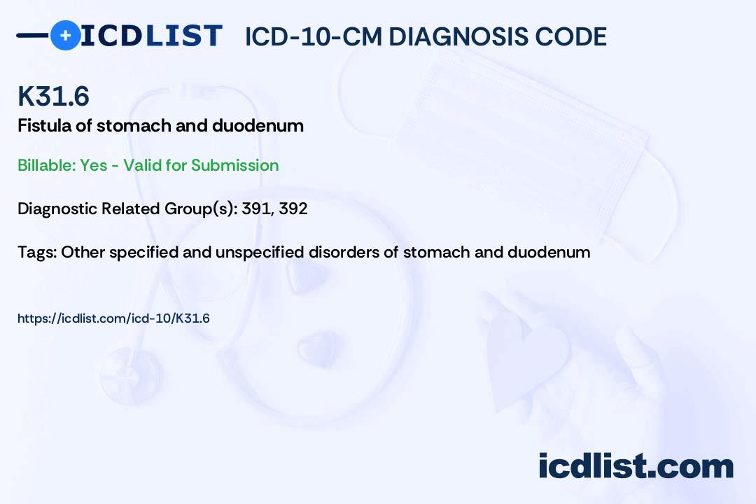 ICD-10-CM Diagnosis Code K31.6 - Fistula of stomach and duodenum