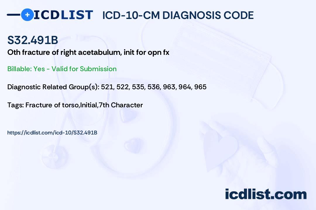 ICD-10-CM Diagnosis Code S32.491B - Other specified fracture of right ...